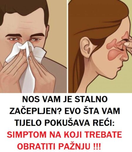 NOS VAM JE STALNO ZAČEPLJEN? EVO ŠTA VAM TIJELO POKUŠAVA REĆI: Simptom ...